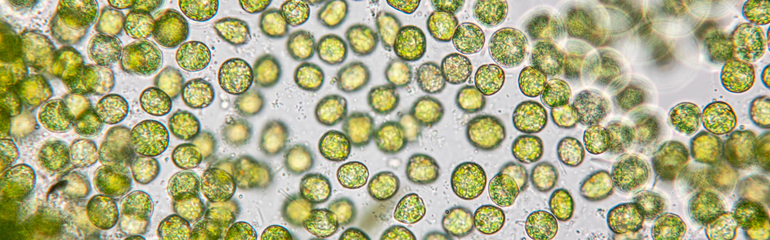 Chlorella Vulgaris: Nutrient-Rich Microalgae for Detox & Health