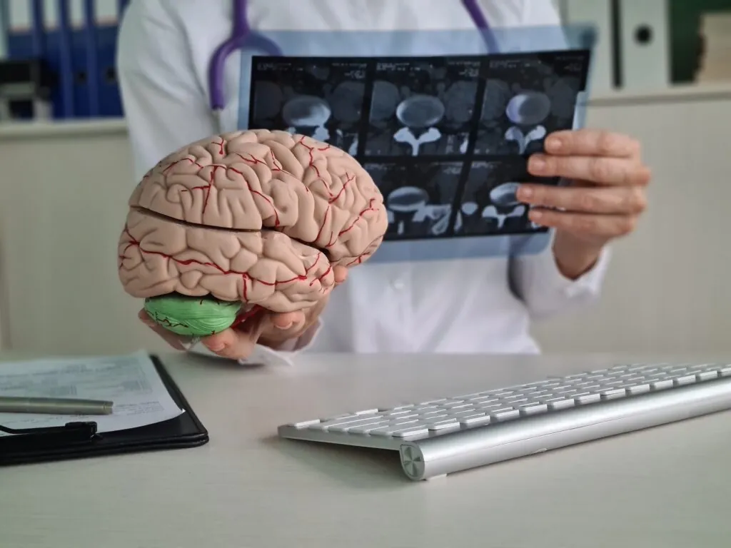 Brain Health - WholisticMatters